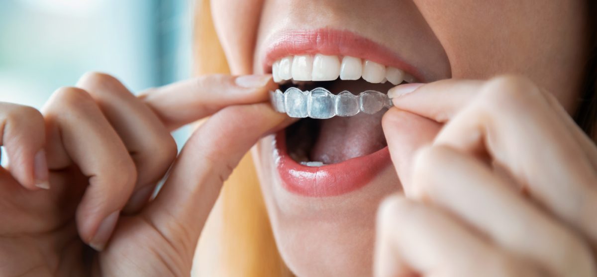 KFO - CS-Zahntechnik in Landsberg am Lech